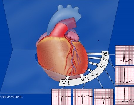 Advanced 12-Lead ECG Interpretation Online CNE Nursing Course | Mayo Clinic School of Continuous ...